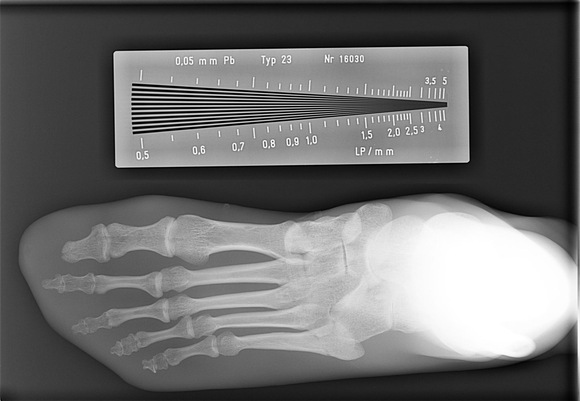 La importancia de la resolución espacial en la radiología | Technodomus